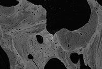 Cryo Microscopie électronique à balayage - Plateforme SC3M